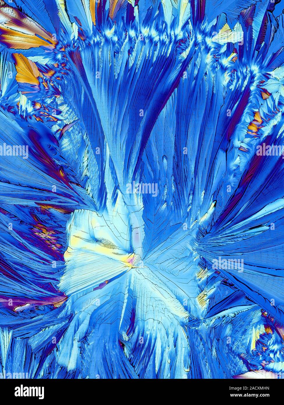 Cortisol crystals, polarised light micrograph. Cortisol is a steroid ...