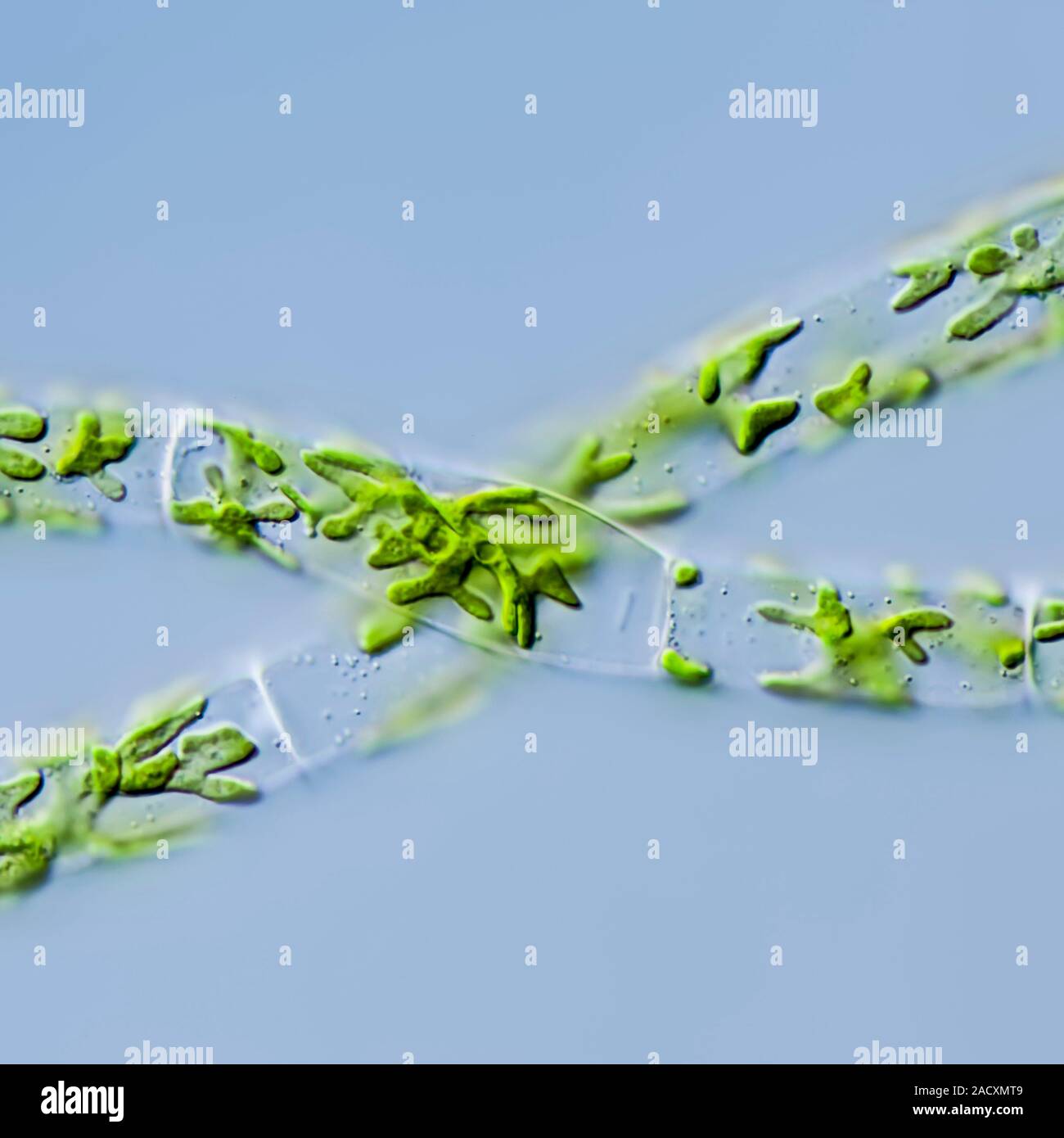 Light micrograph of Zygnema pseudogedeanum (Gr. zygon, yoke + Gr. nema ...