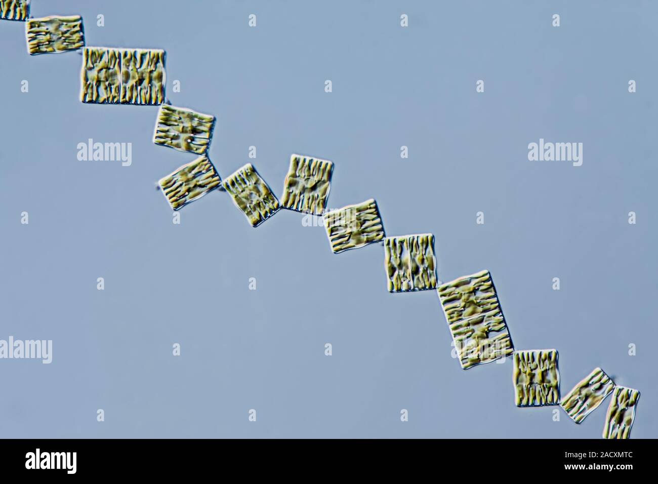 Light micrograph of Diatoma sp., a freshwater diatom. Culture material ...