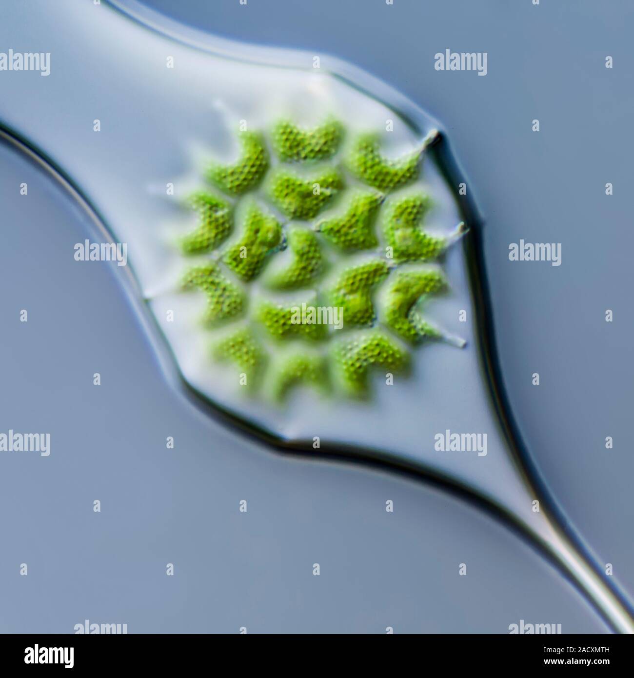 Light micrograph of a Pediastrum sp. (Gr. pedion, plain + Gr. astron ...