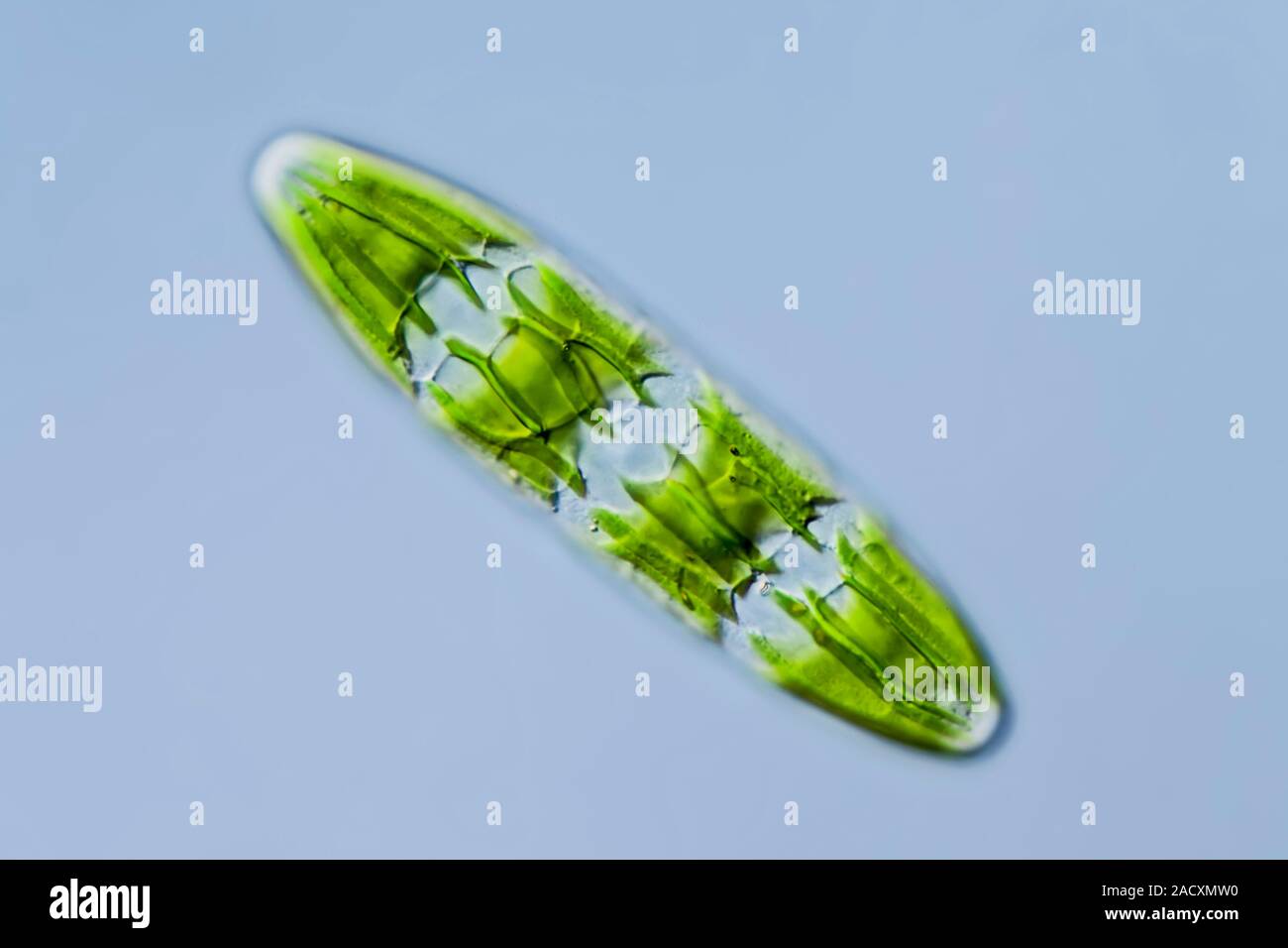 Light micrograph of Planotaenium sp., a freshwater green alga, family ...