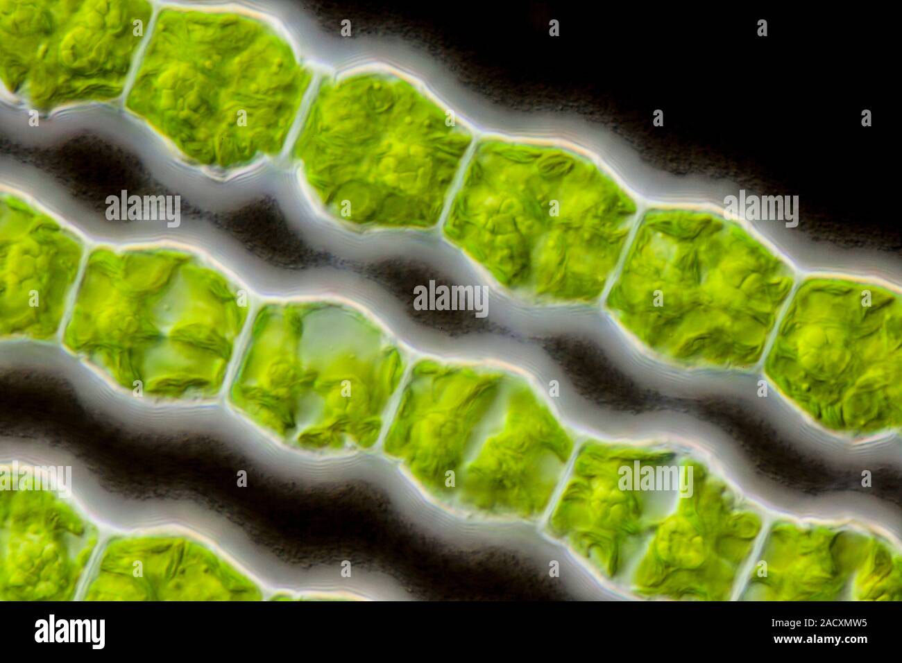 Light micrograph of Bambusina sp. (named for Bambusa, a genus of bamboo ...
