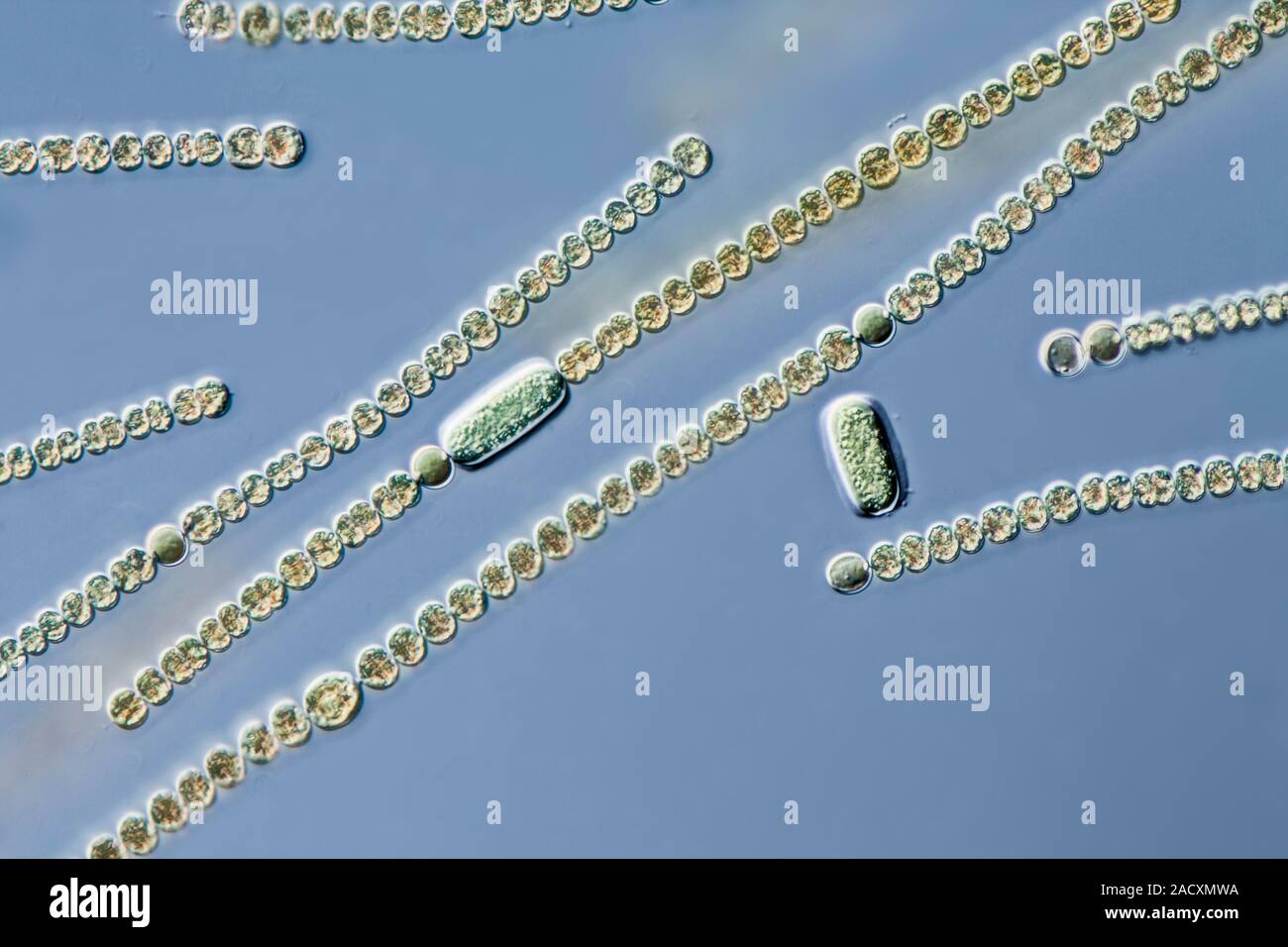 Light micrograph of Anabena sp. (Gr. anabaino, to rise), a freshwater ...