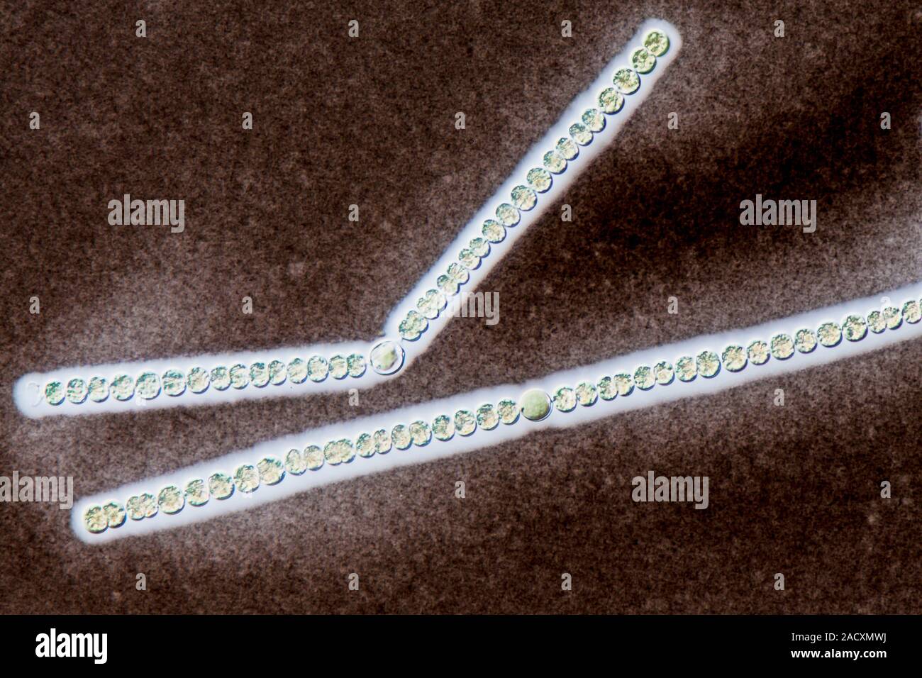 Light micrograph of Anabena sp. (Gr. anabaino, to rise), a freshwater ...