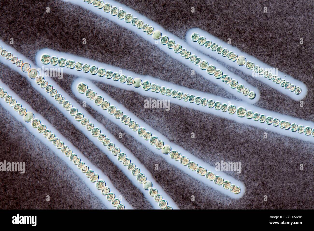 Light micrograph of Anabena sp. (Gr. anabaino, to rise), a freshwater ...