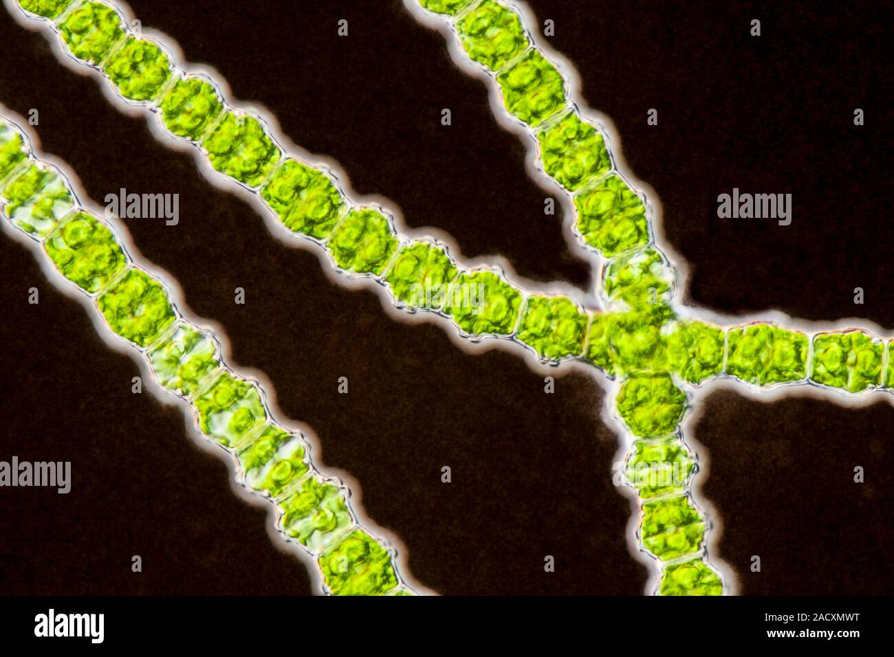 Light micrograph of Bambusina sp. (named for Bambusa, a genus of bamboo ...