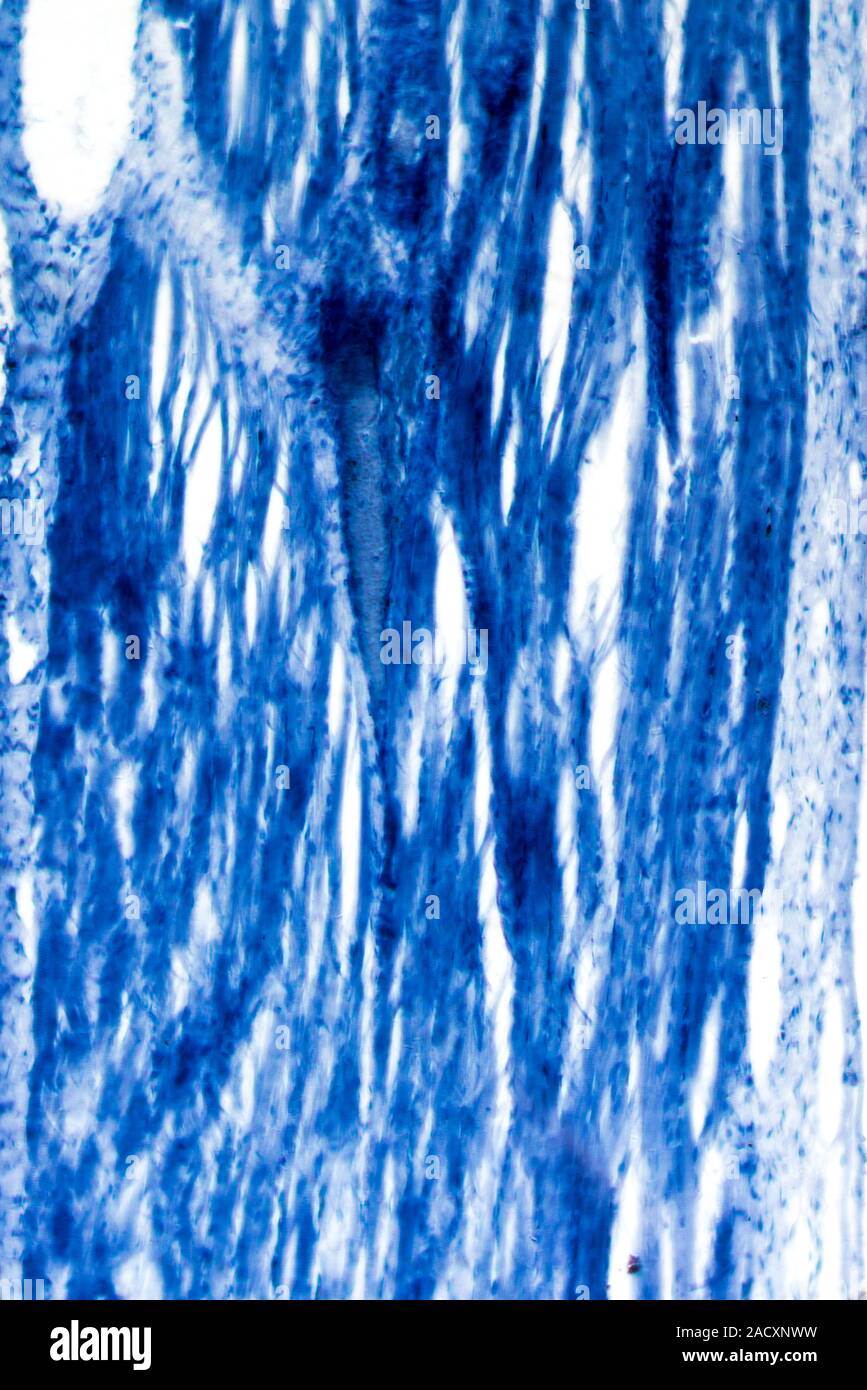 Skeletal muscle in longitudinal section, light micrograph. Muscle ...