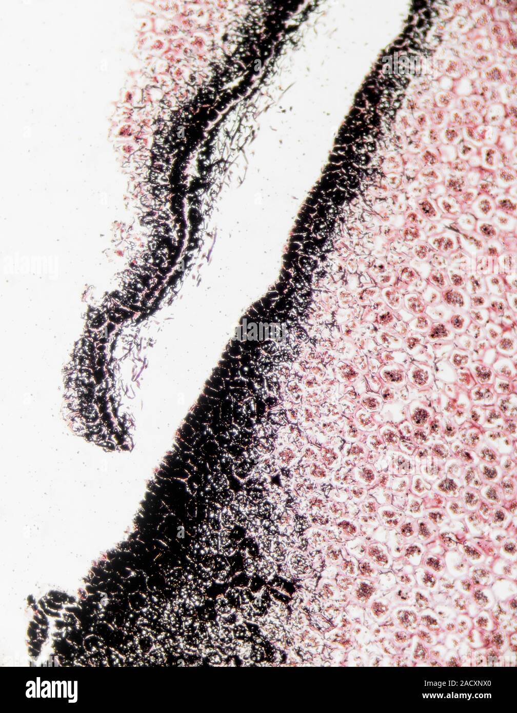 Aflatoxin fungal plant infection of plant cells, light micrograph ...