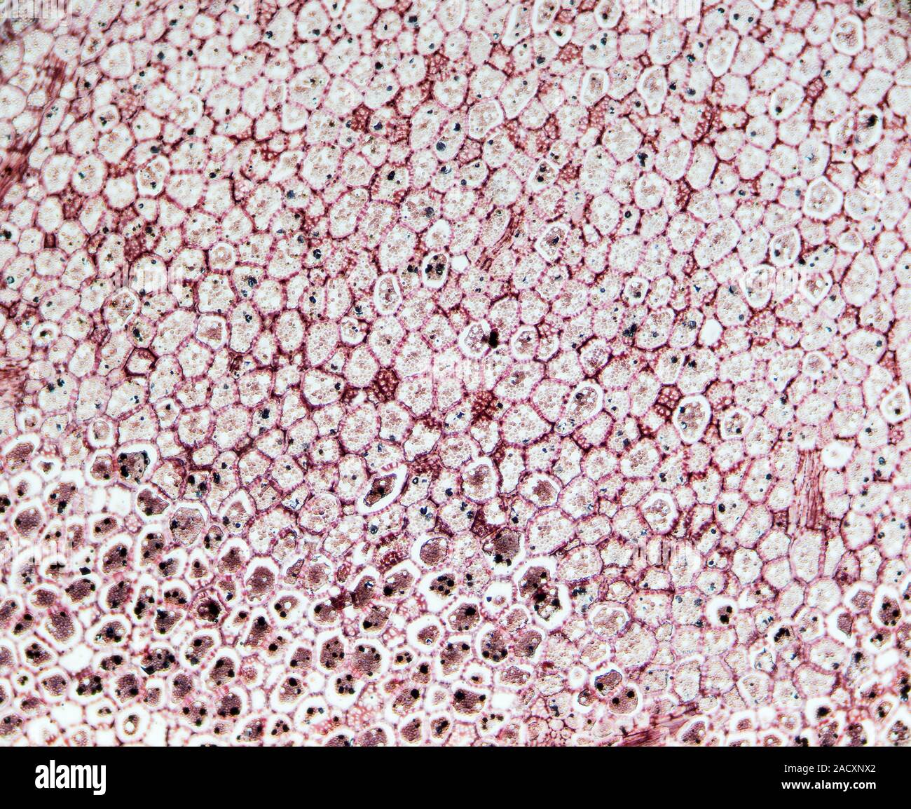 Aflatoxin fungal plant infection of plant cells, light micrograph ...