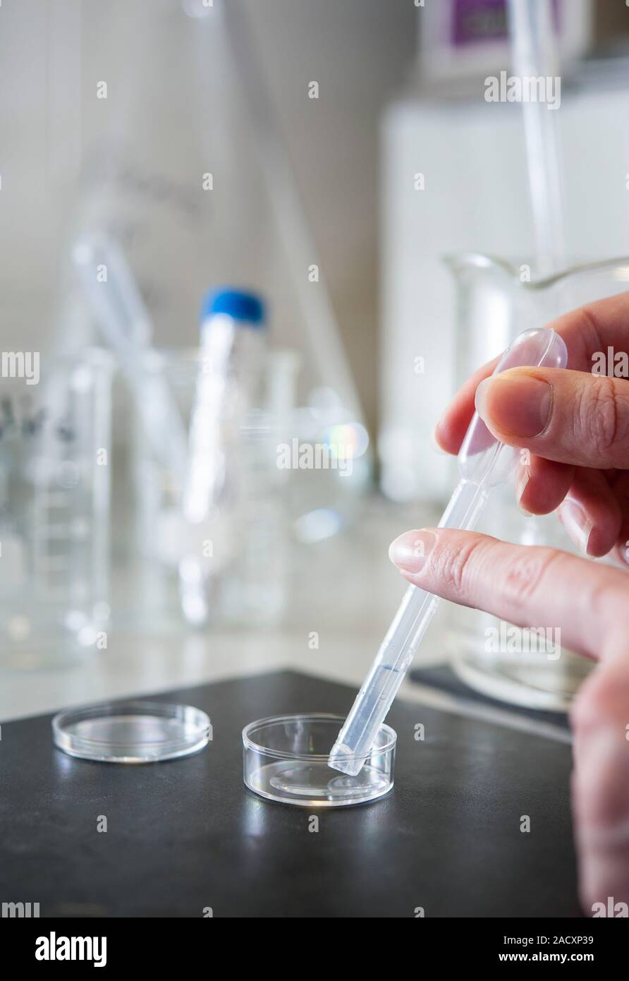 Brain tissue sample preparation. Close-up of a microbiologist preparing ...