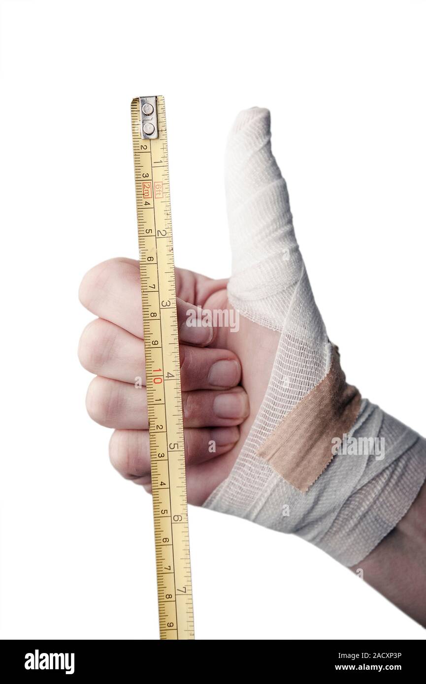 Thumb in a bandage following an injury caused by a retractable tape ...