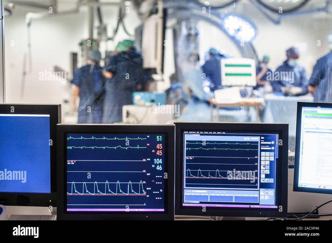 Surgical monitors being used to track the vital signs of a patient ...
