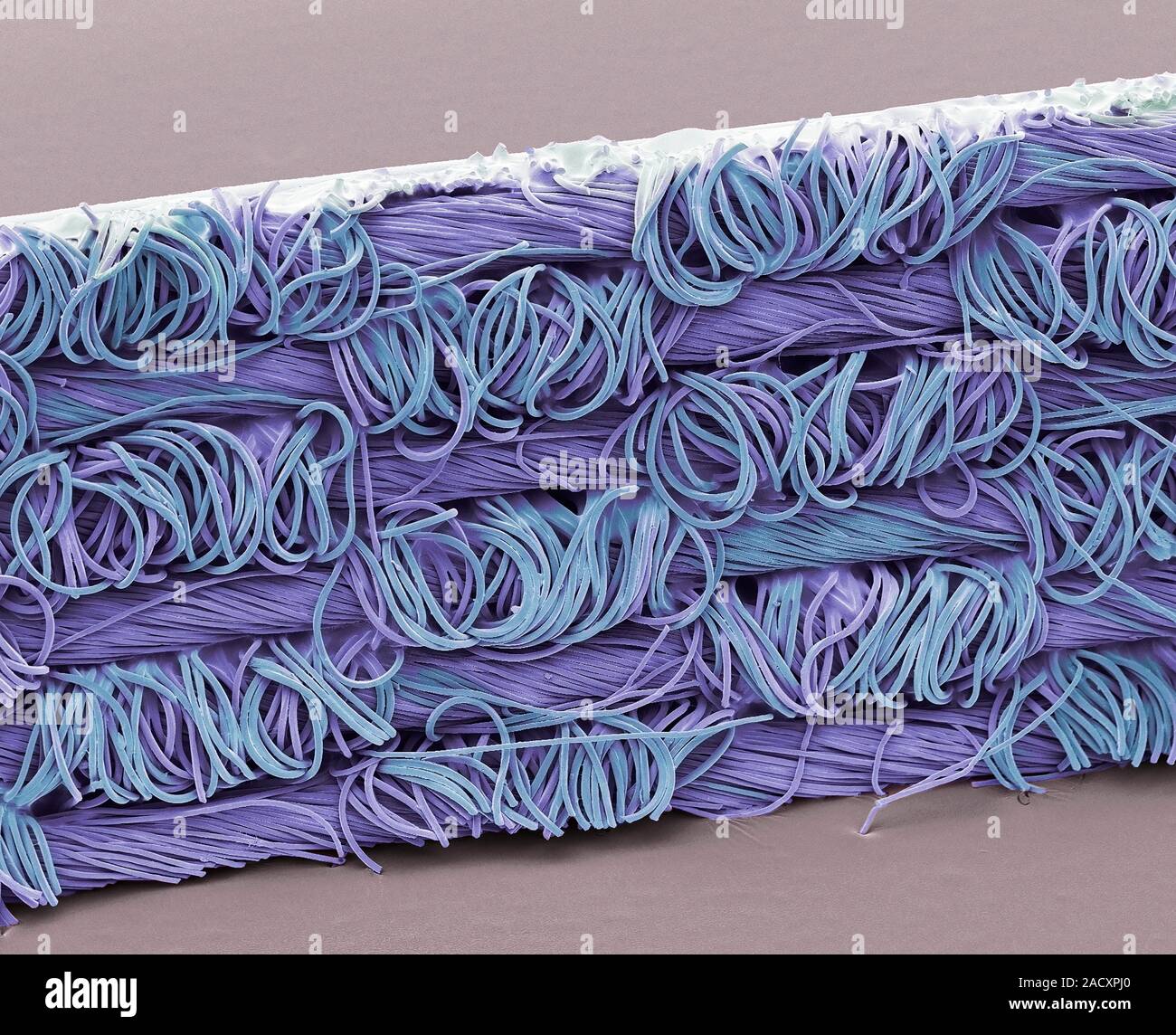 Transdermal patch. Scanning electron micrograph (SEM) of a section of a ...