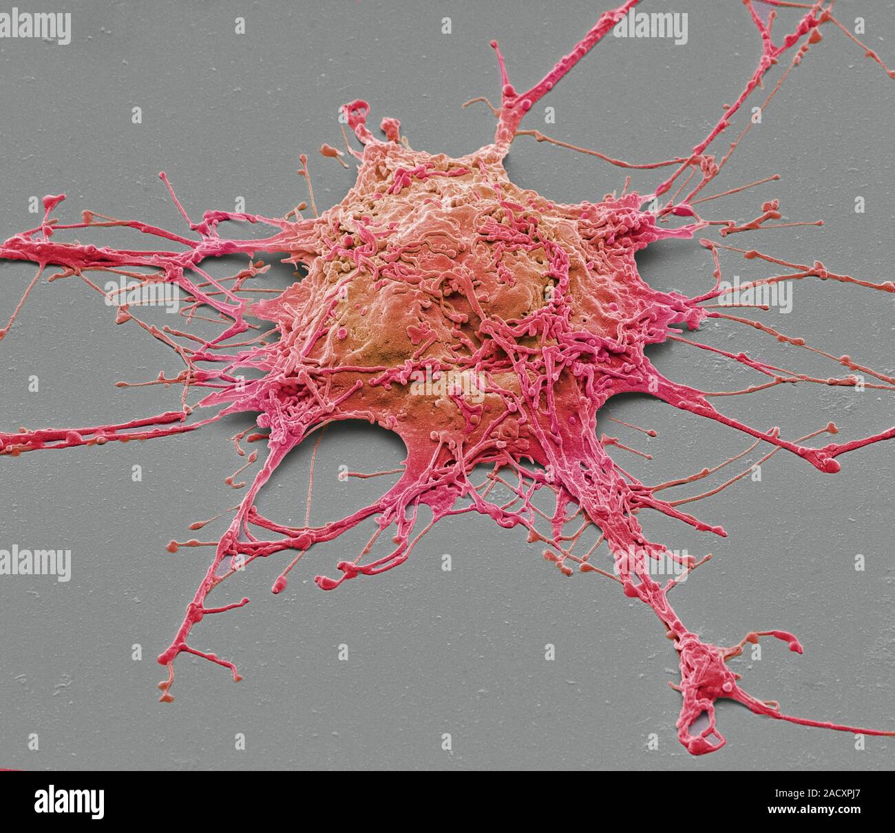 Neurone. Scanning electron micrograph (SEM) of a PC12 neurone in ...