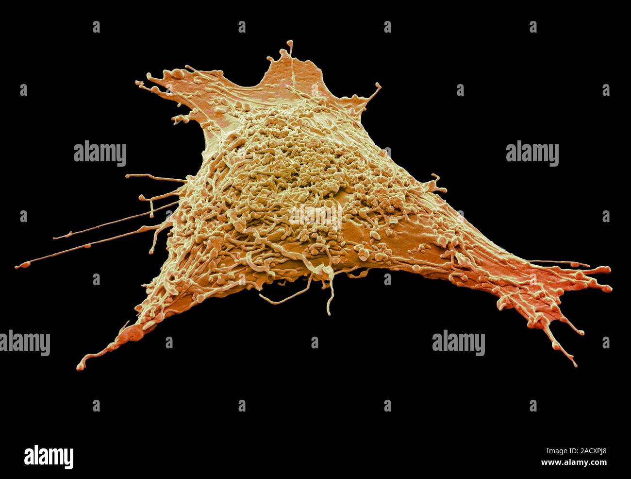 Neurone. Scanning electron micrograph (SEM) of a PC12 neurone in ...