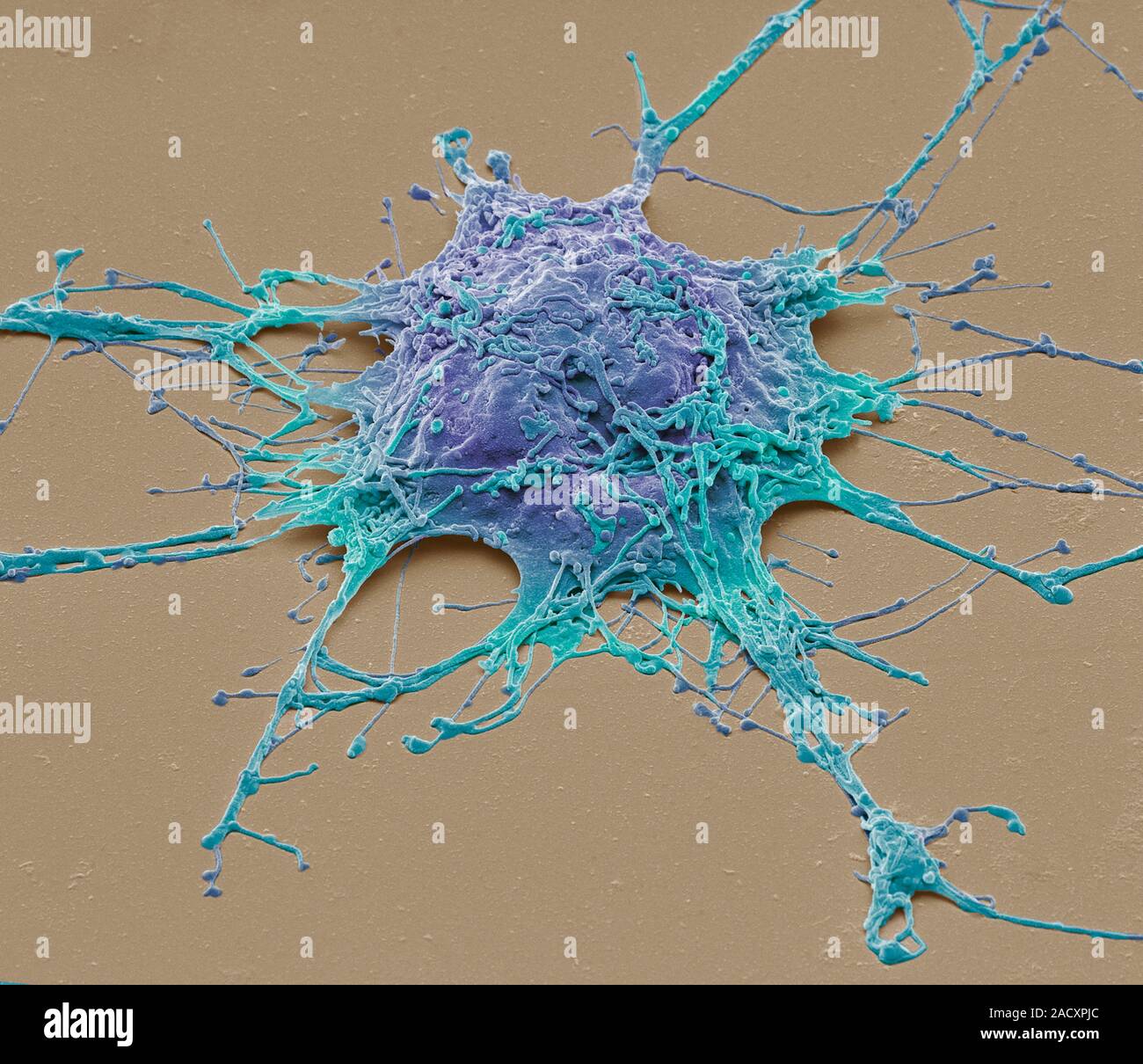 Neurone. Scanning electron micrograph (SEM) of a PC12 neurone in ...