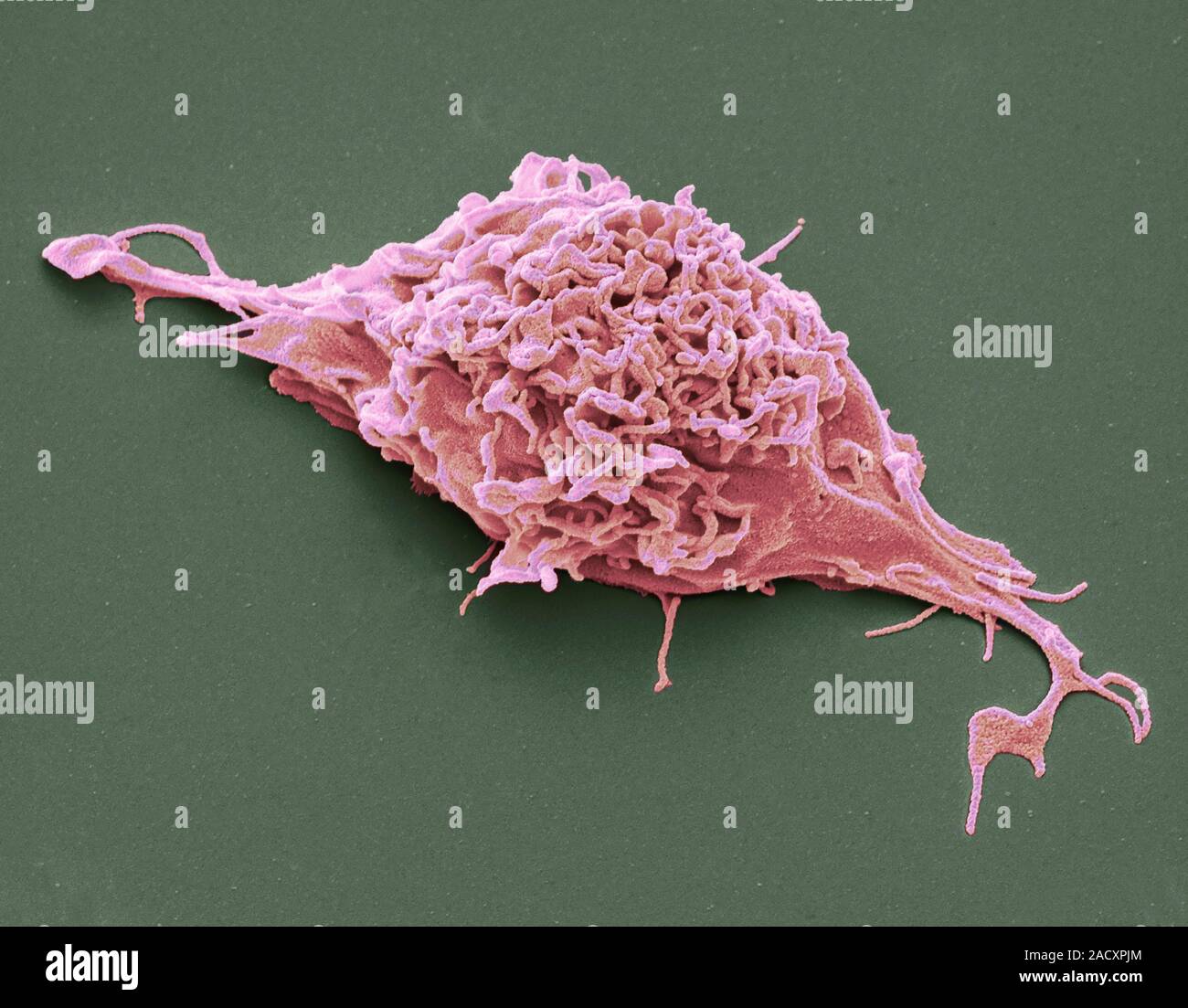 Bone marrow stem cell. Coloured scanning electron micrograph (SEM) of a ...
