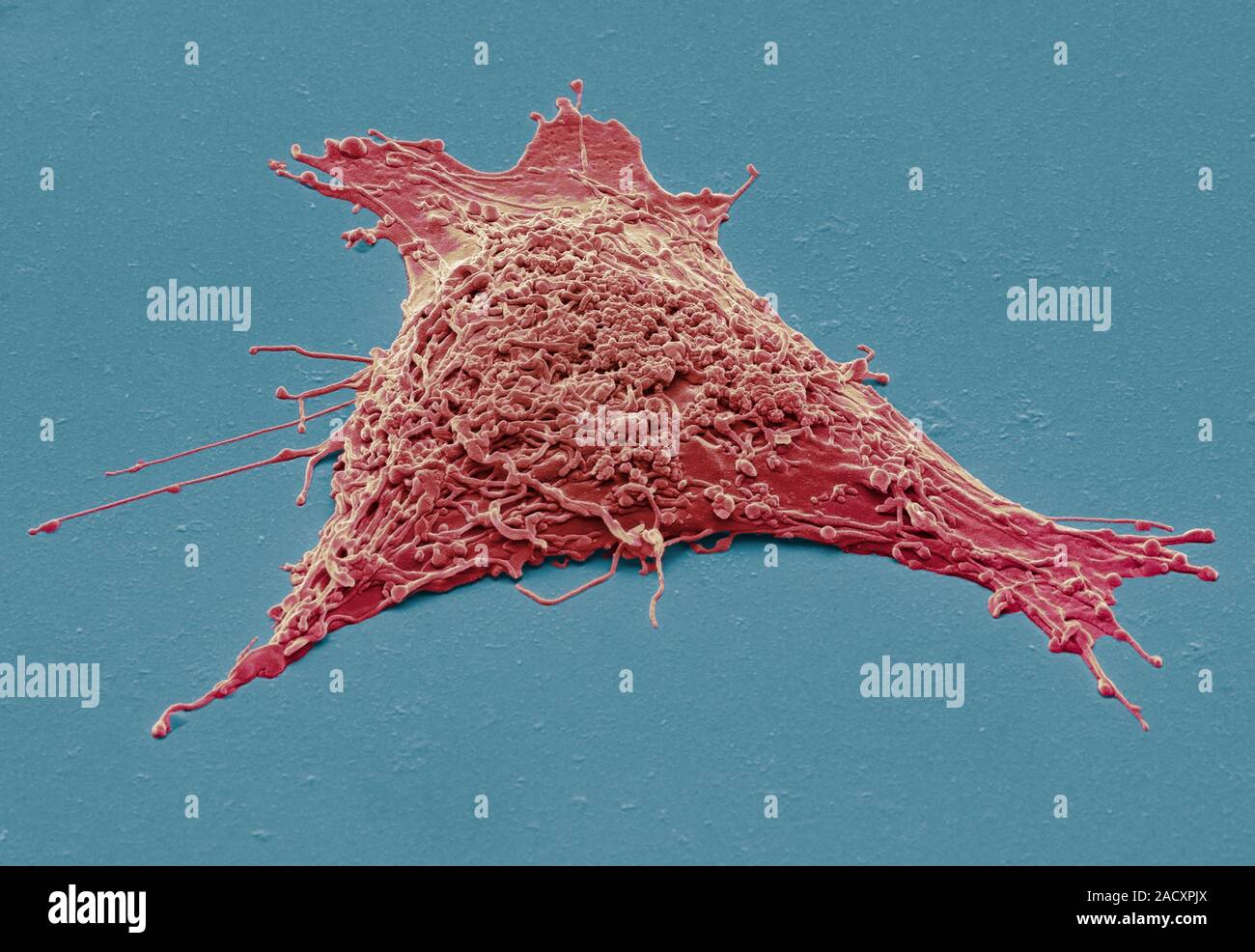 Neurone. Scanning electron micrograph (SEM) of a PC12 neurone in ...