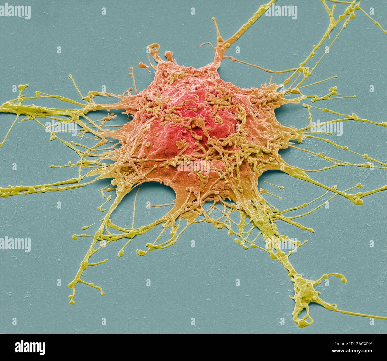 Neurone. Scanning electron micrograph (SEM) of a PC12 neurone in ...