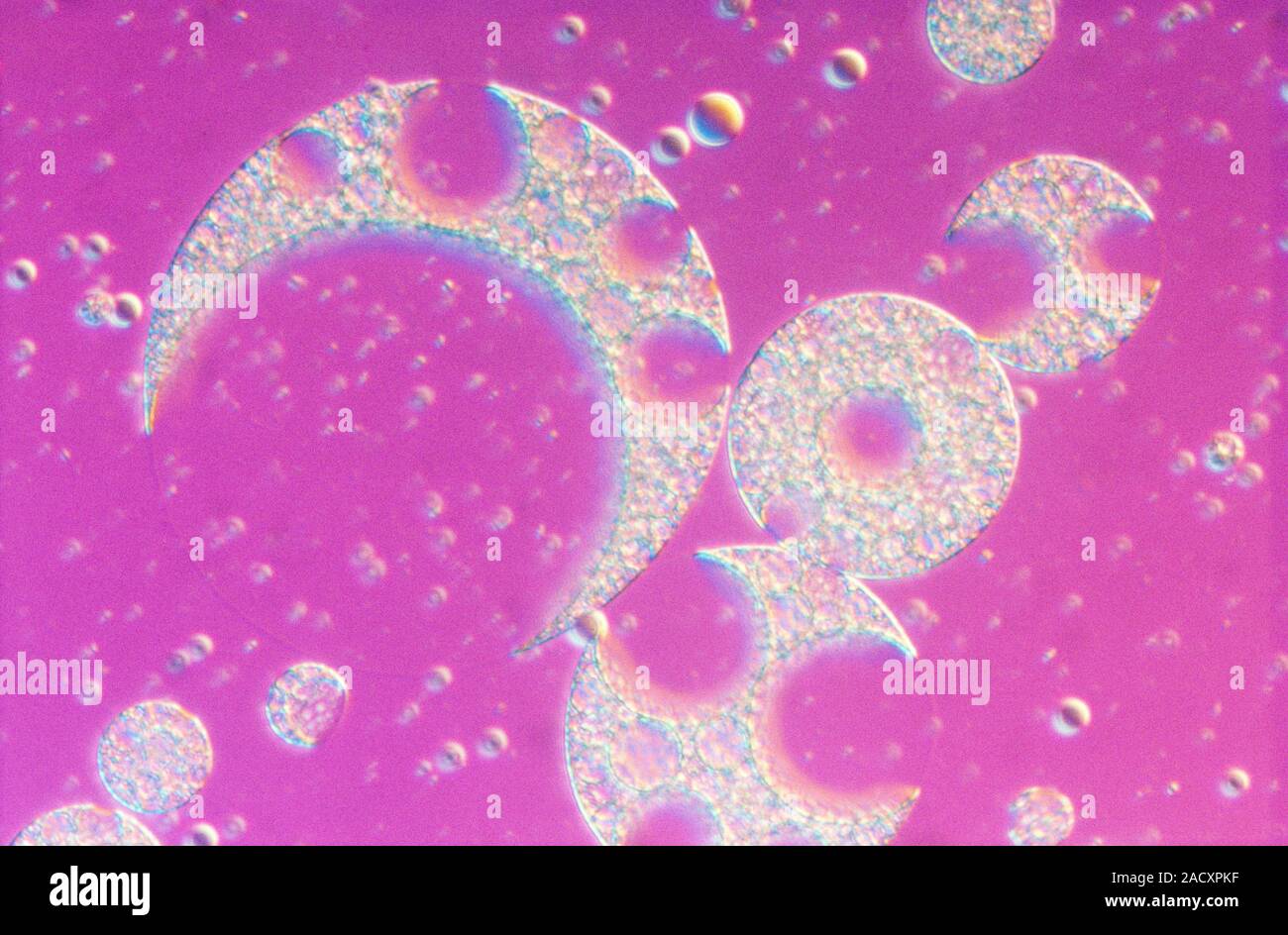 Differential interference contrast (DIC) light micrograph of a water-in ...
