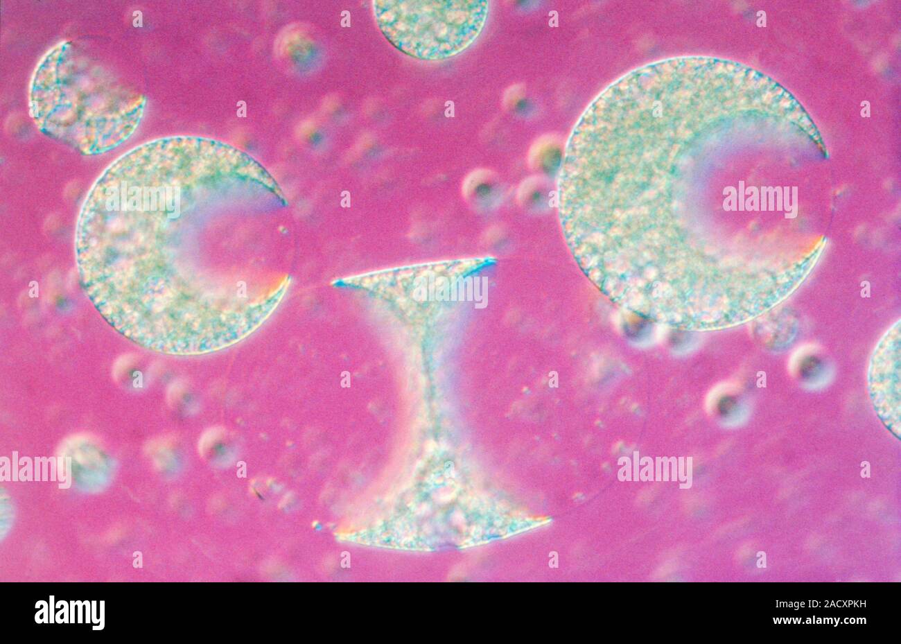 Differential interference contrast (DIC) light micrograph of a water-in ...