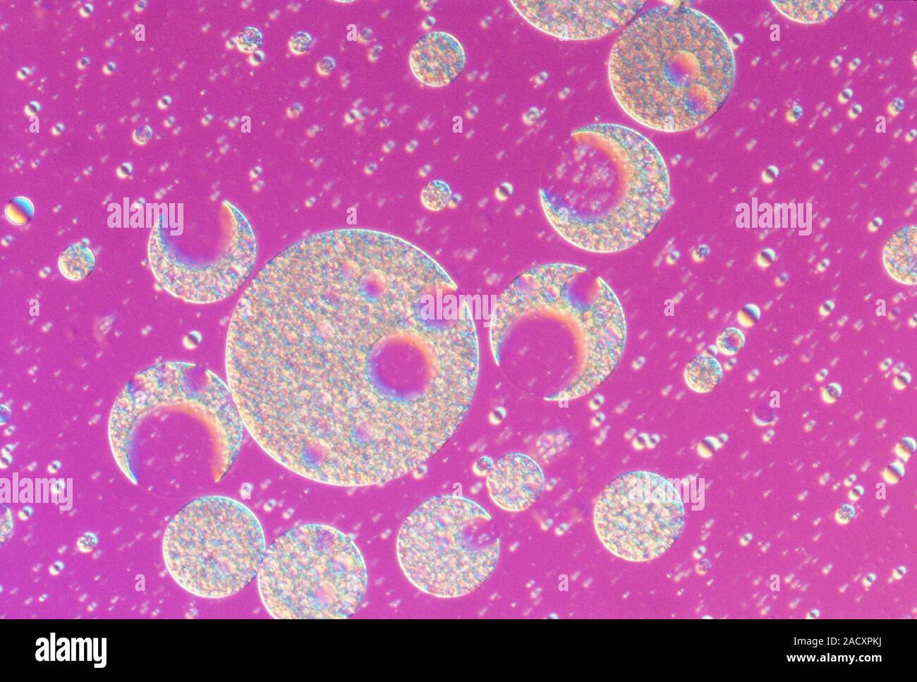 Differential interference contrast (DIC) light micrograph of a water-in ...