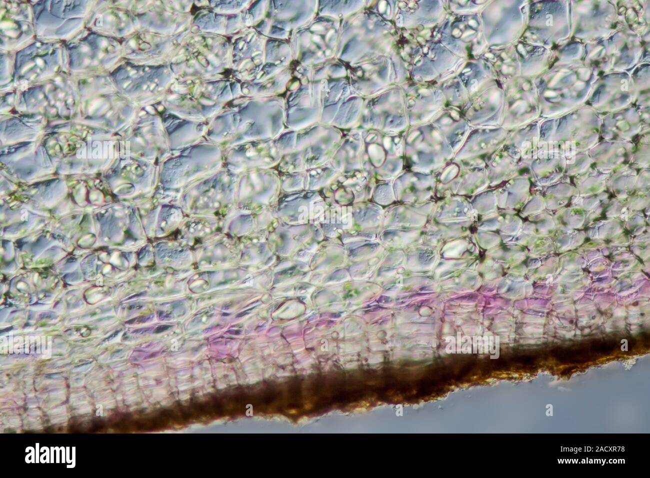 Light micrograph of a thin section through a potato tuber, solanum ...