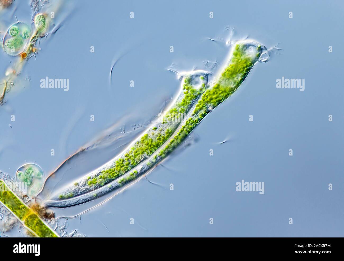 Light micrograph of Thuricola folliculata, a peritriche ciliate ...