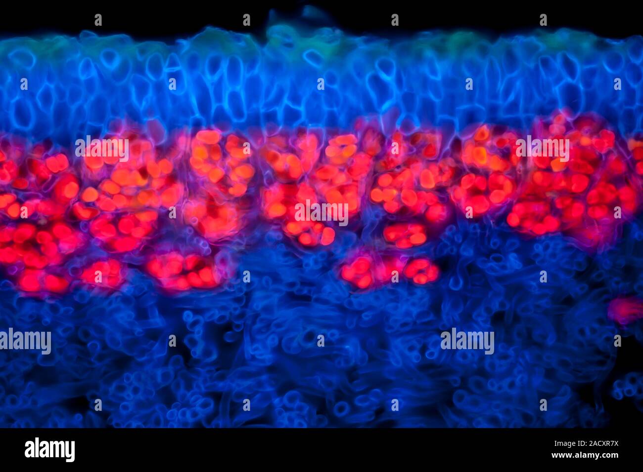 Light micrograph of a thin section through a Peltigera sp. lichen in ...