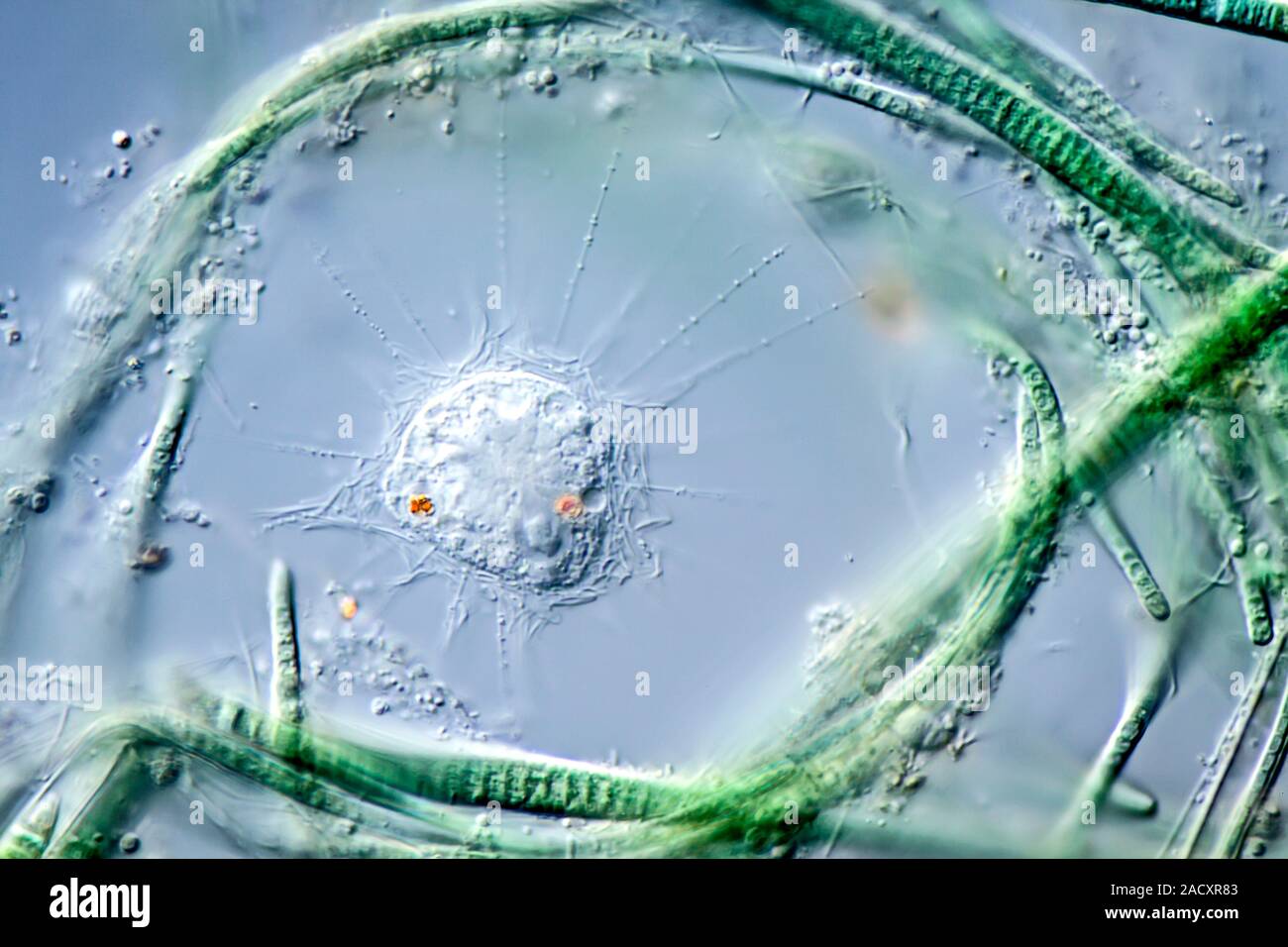 Light micrograph of Raphidiophrys sp. heliozoan with surrounding ...