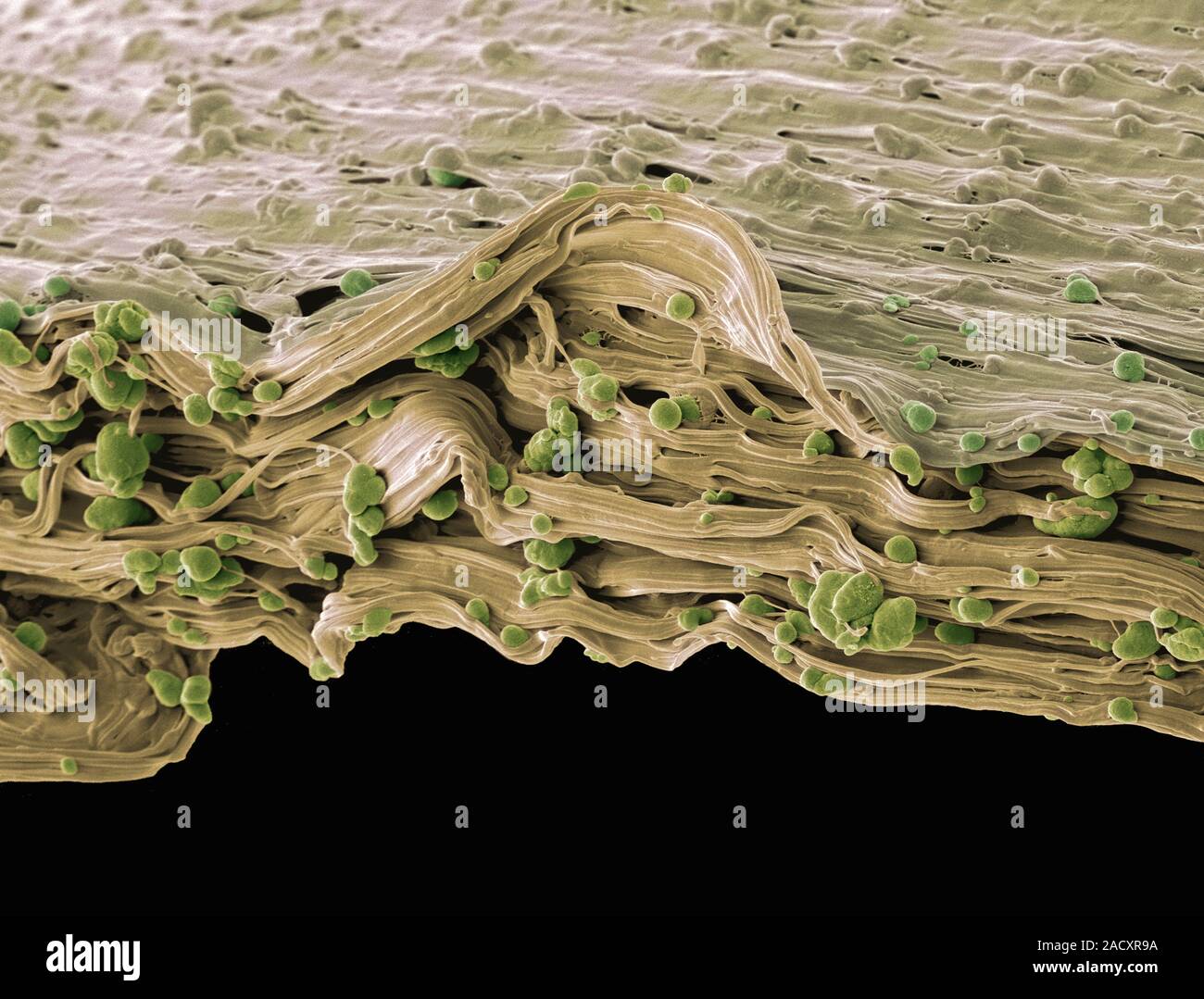 Coloured scanning electron micrograph (SEM) of material from a ...