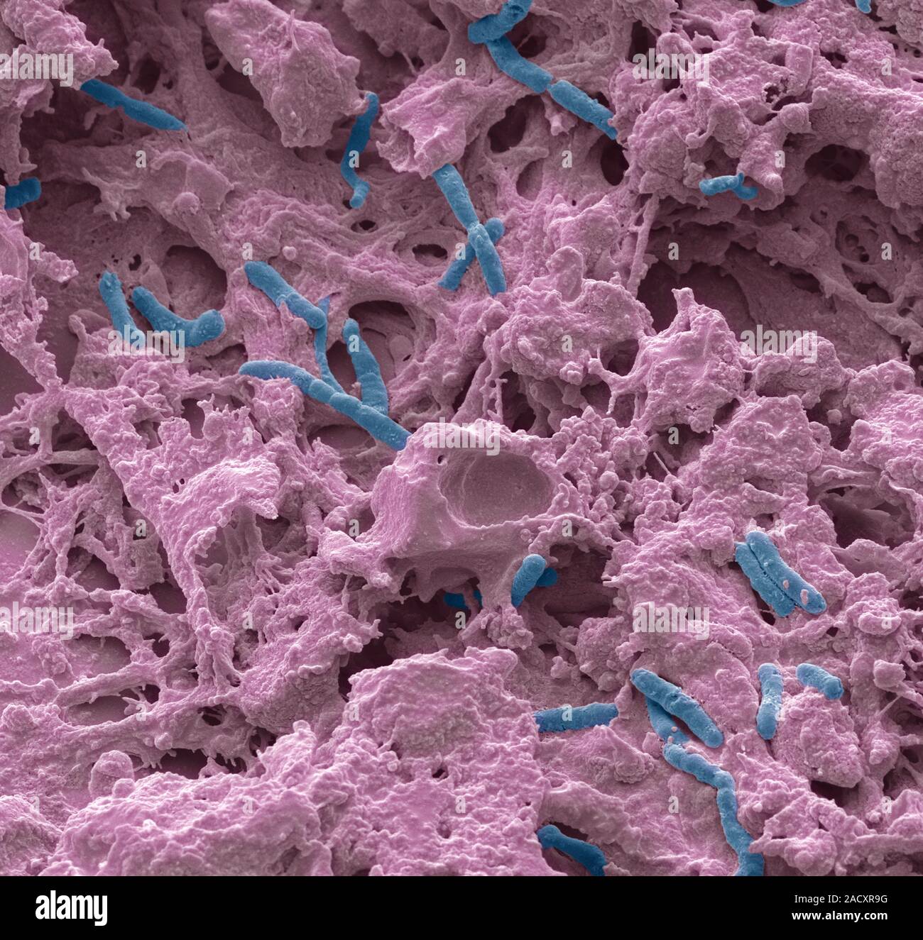 Coloured scanning electron micrograph (SEM) Pseudomonas aeruginosa ...