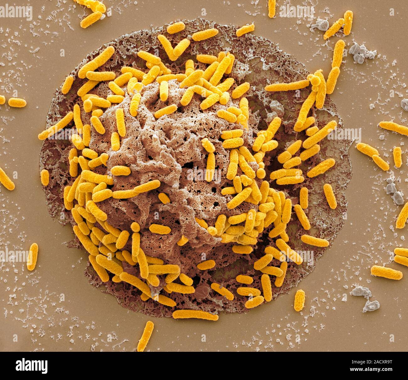 E. coli induced cell death. Coloured scanning electron micrograph (SEM ...