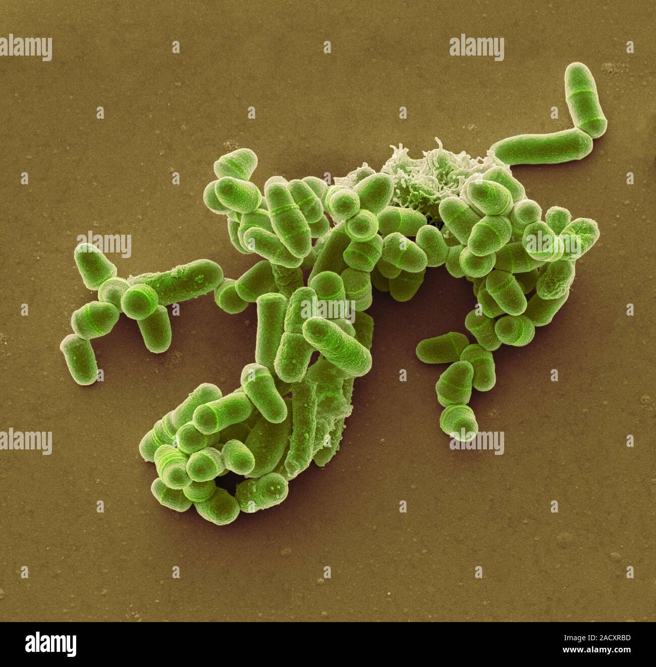 Coloured scanning electron micrograph (SEM) of Schizosaccharomyces ...