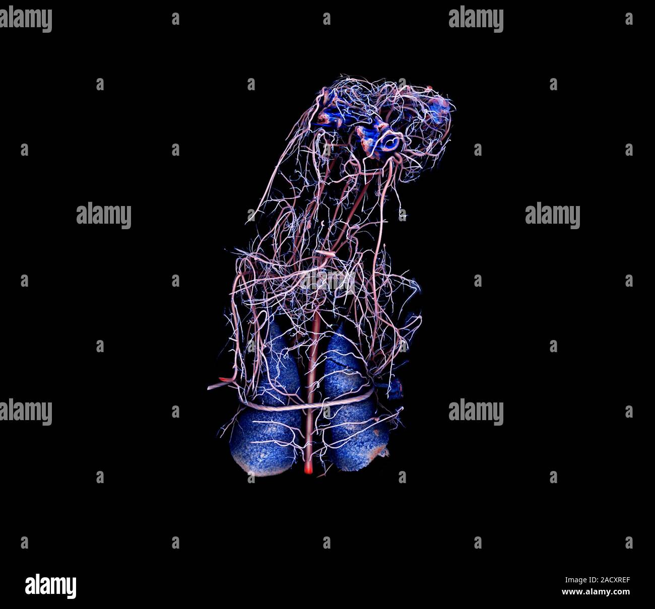 Circulatory System Of Rabbit Anatomy Diagram Of A Rabbit" Magnet For