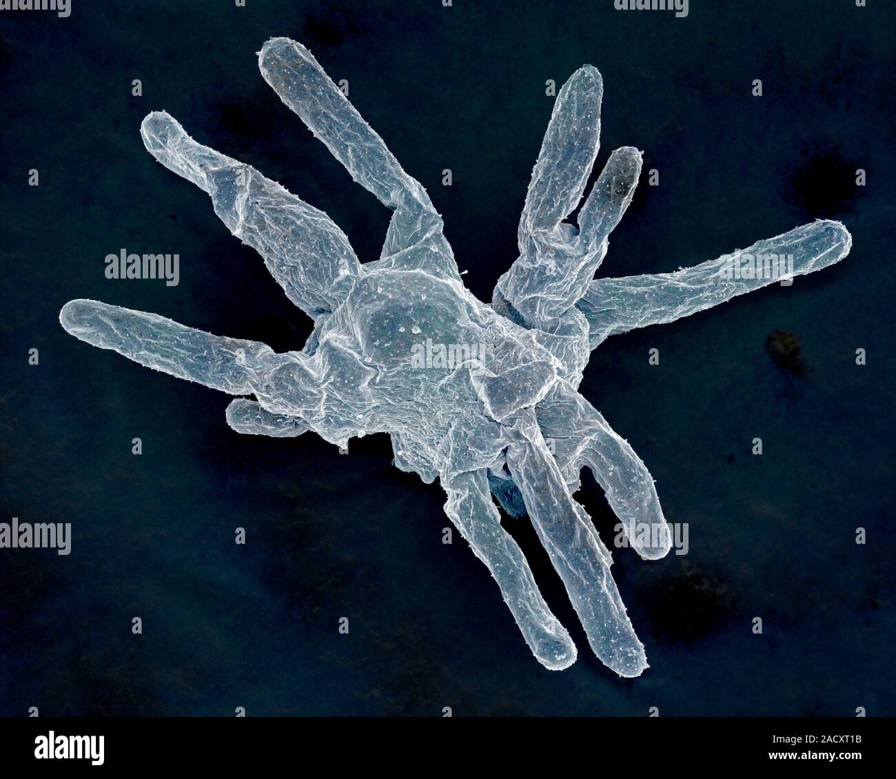 Amoeba. Coloured scanning electron micrograph (SEM) of an amoeba, a single-celled (protozoan ...