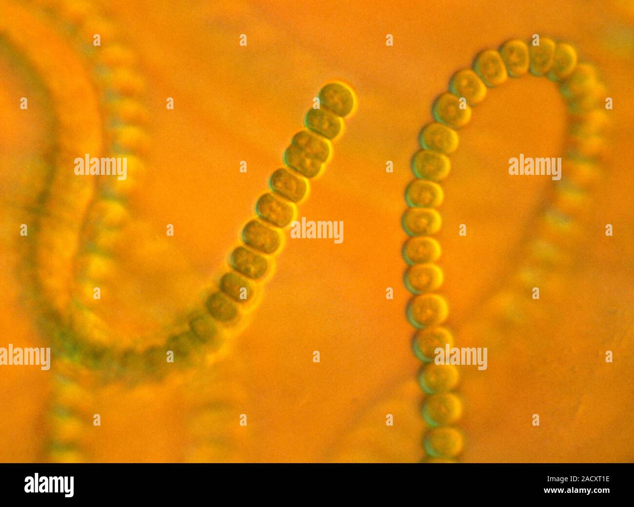 Light micrograph of Anabaena sp., a member of the Cyanophyta division ...