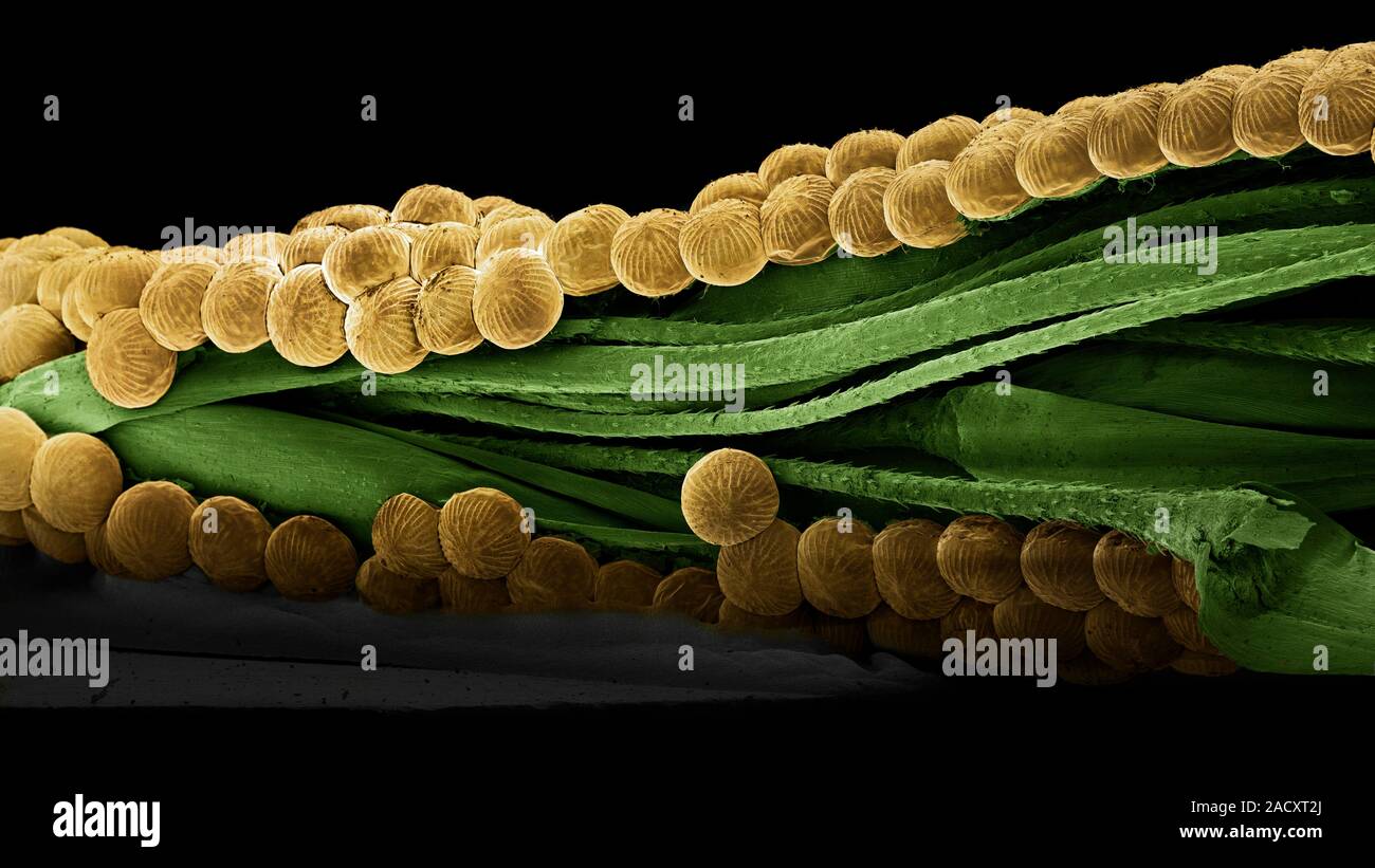 Spectacle moth eggs. Coloured scanning electron micrograph (SEM) of the ...