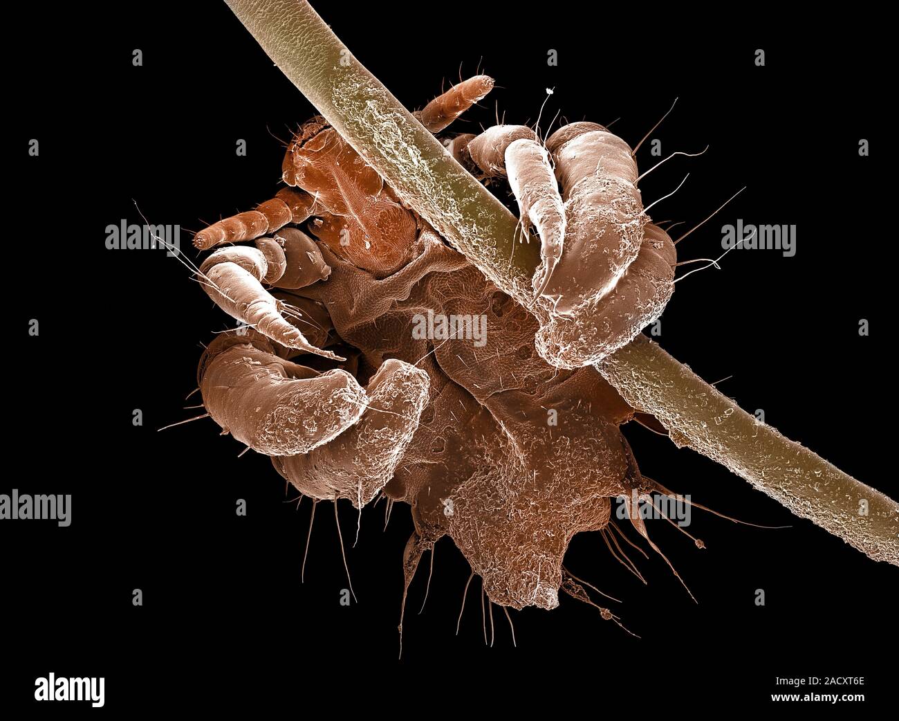 Pubic louse. Coloured Scanning Electron Micrograph (SEM) of a pubic ...