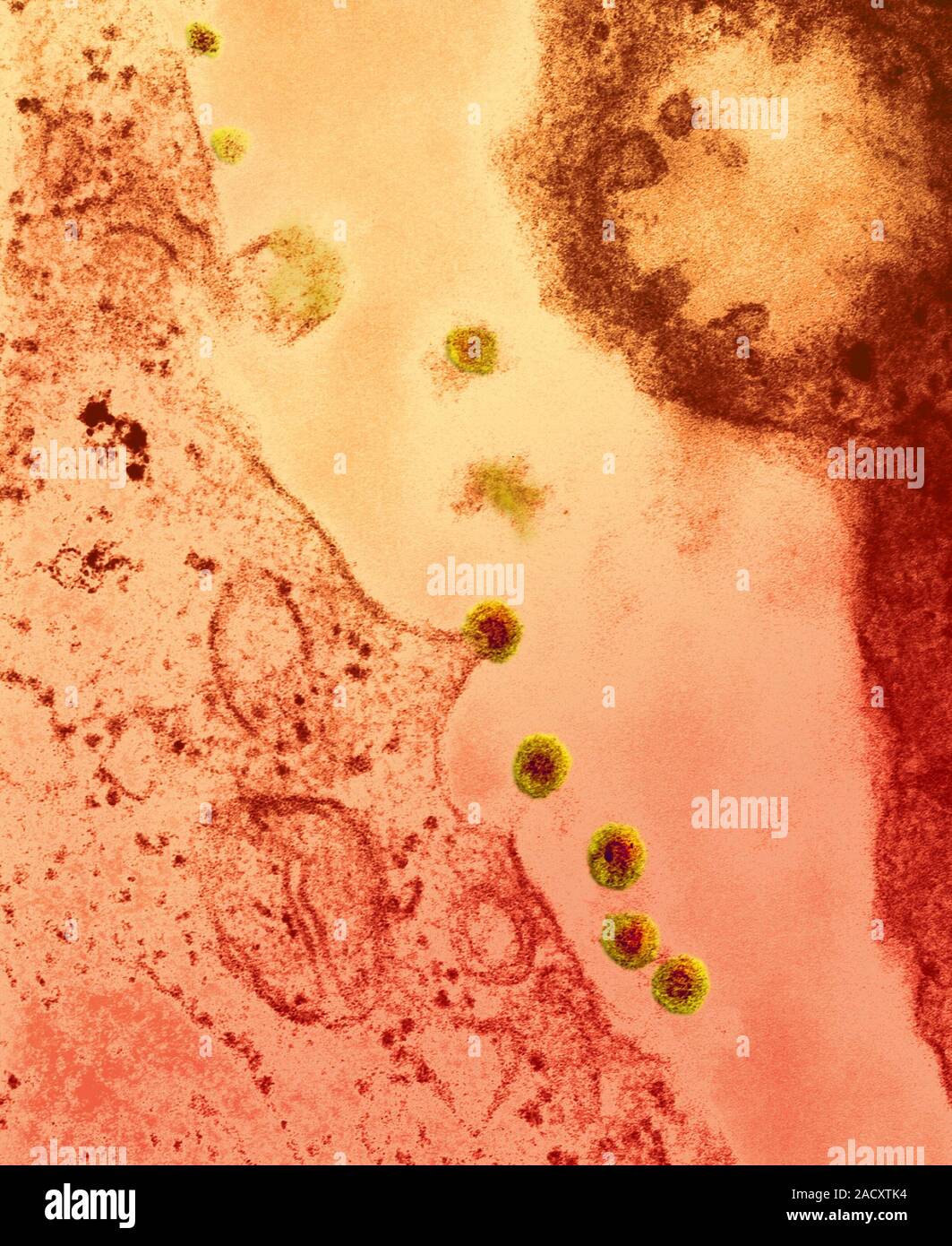 Rubella virus particles, coloured transmission electron micrograph (TEM ...
