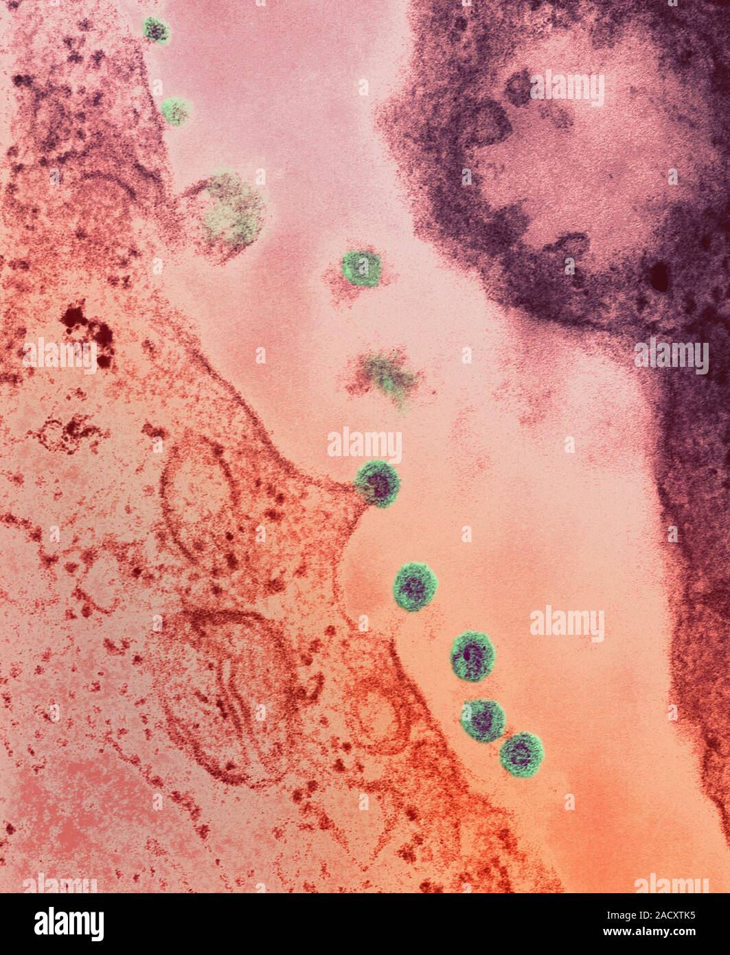 Rubella virus particles, coloured transmission electron micrograph (TEM ...