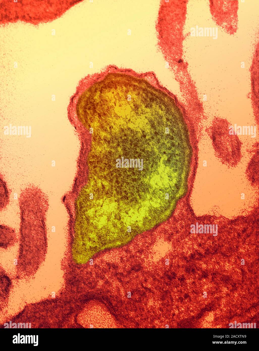 Orientia tsutsugamushi infection. Coloured transmission electron ...