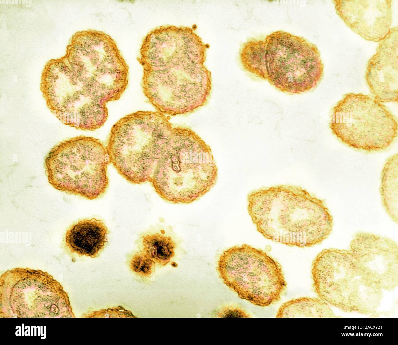Neisseria gonorrhoeae bacteria. Coloured transmission electron ...