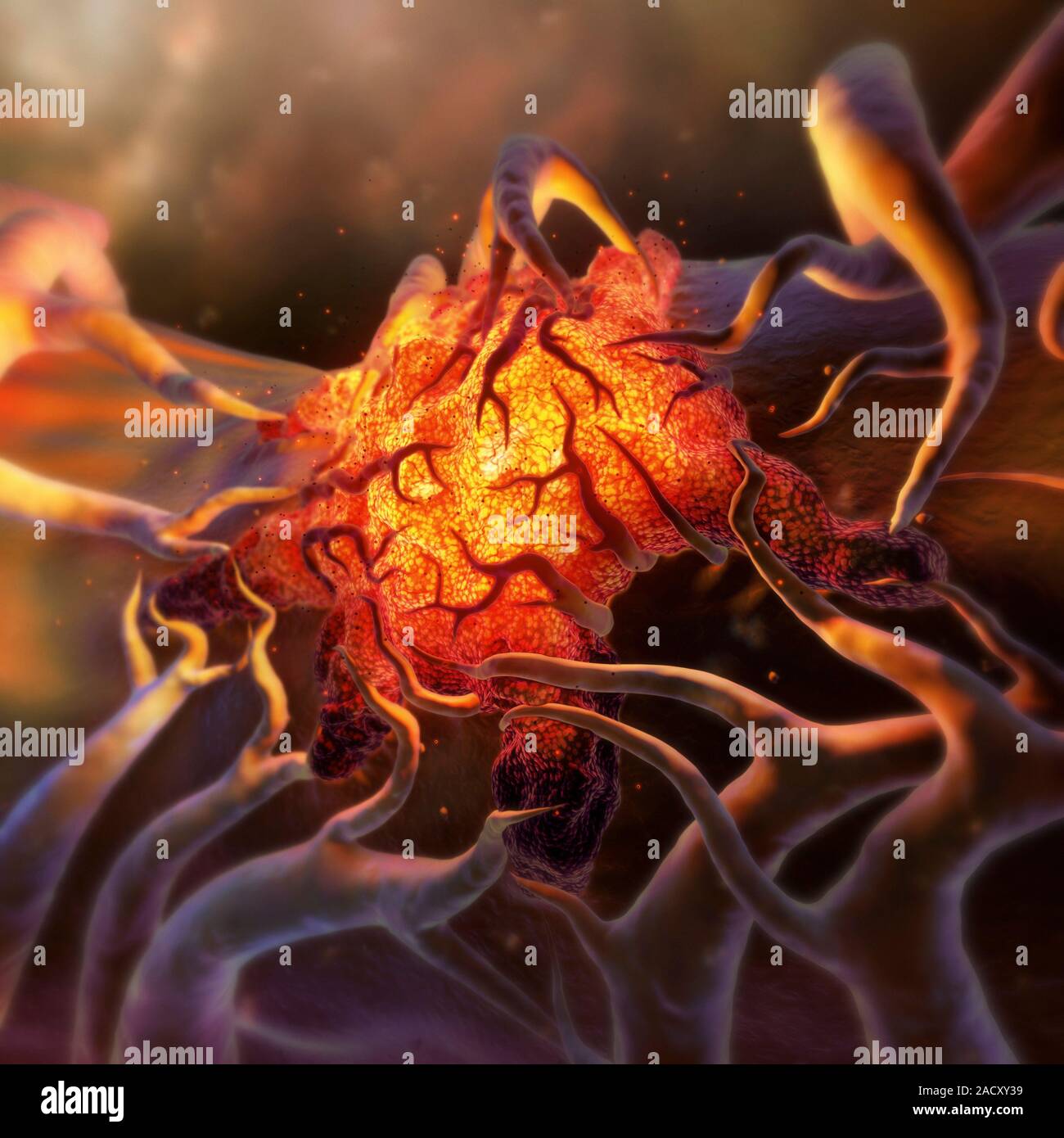 Tumour. Conceptual artwork of a glowing malignant (cancerous) tumour ...