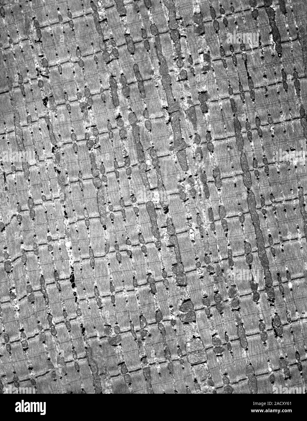 Skeletal muscle tissue. Transmission electron micrograph (TEM) of a ...