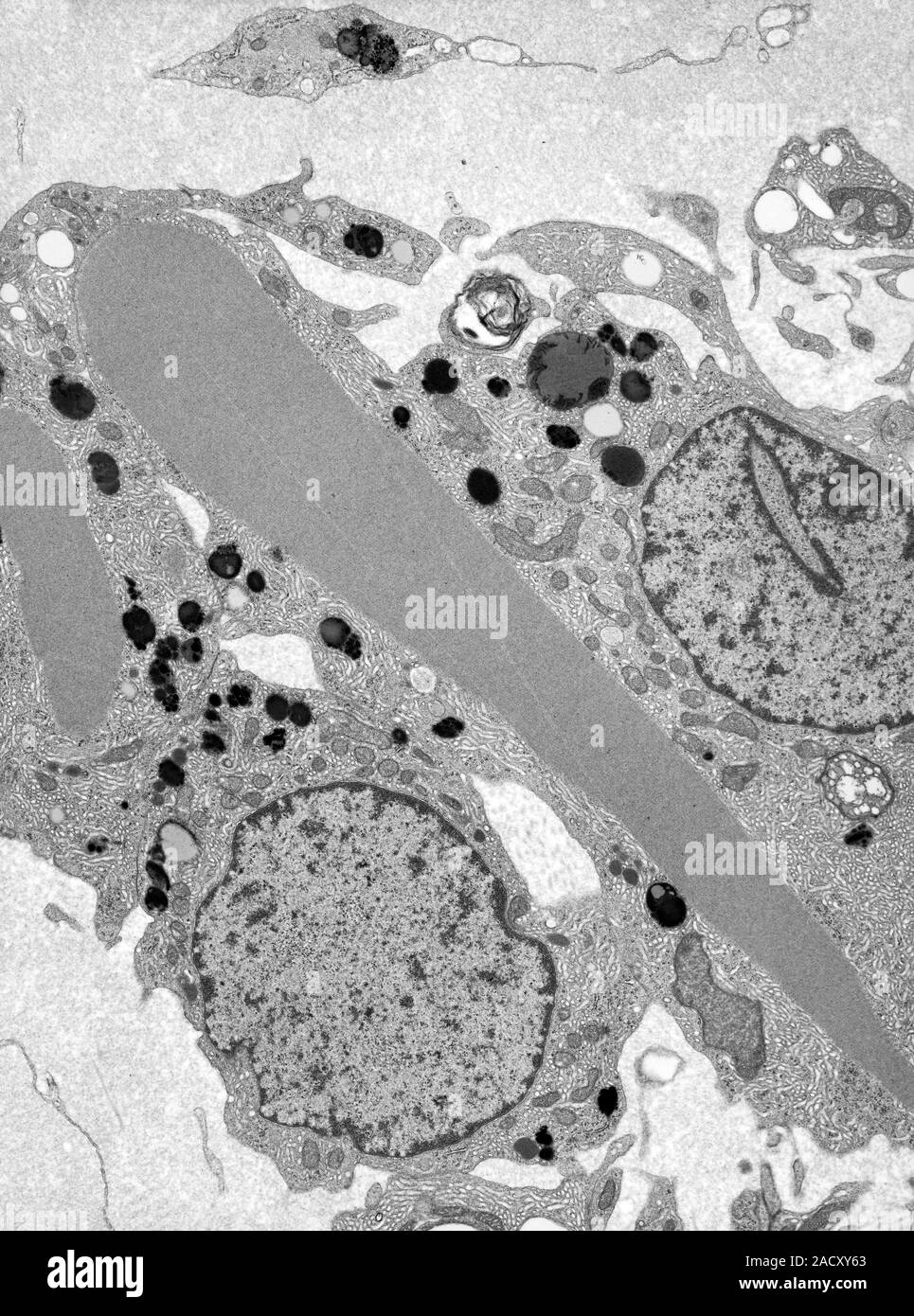 Leydig cells in testis. Transmission electron micrograph (TEM) of a ...