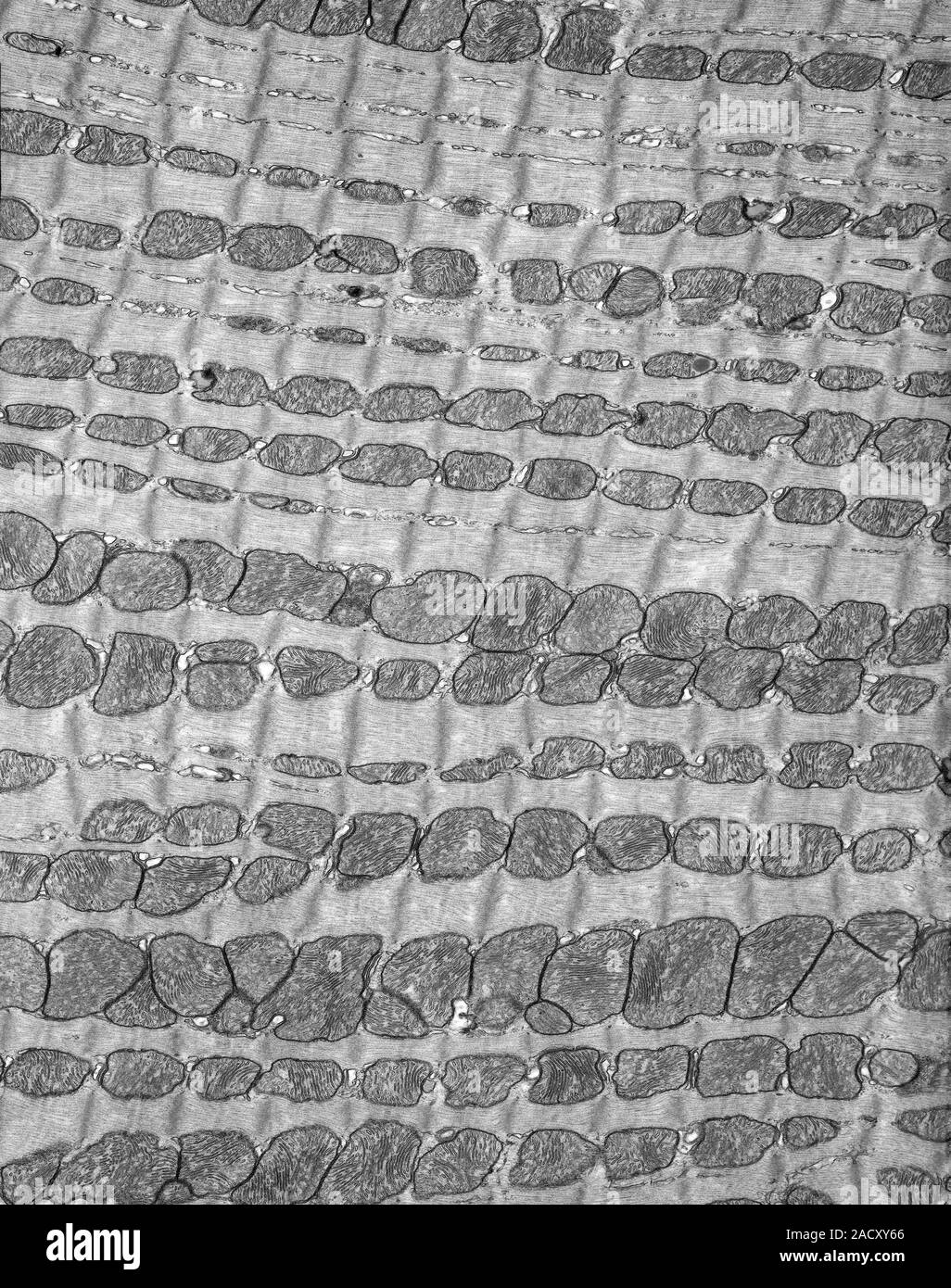 Cardiac muscle. Transmission electron micrograph (TEM) of a section ...