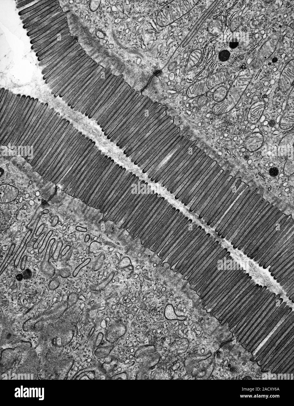 Microvilli. Transmission electron micrograph (TEM) of a section through ...