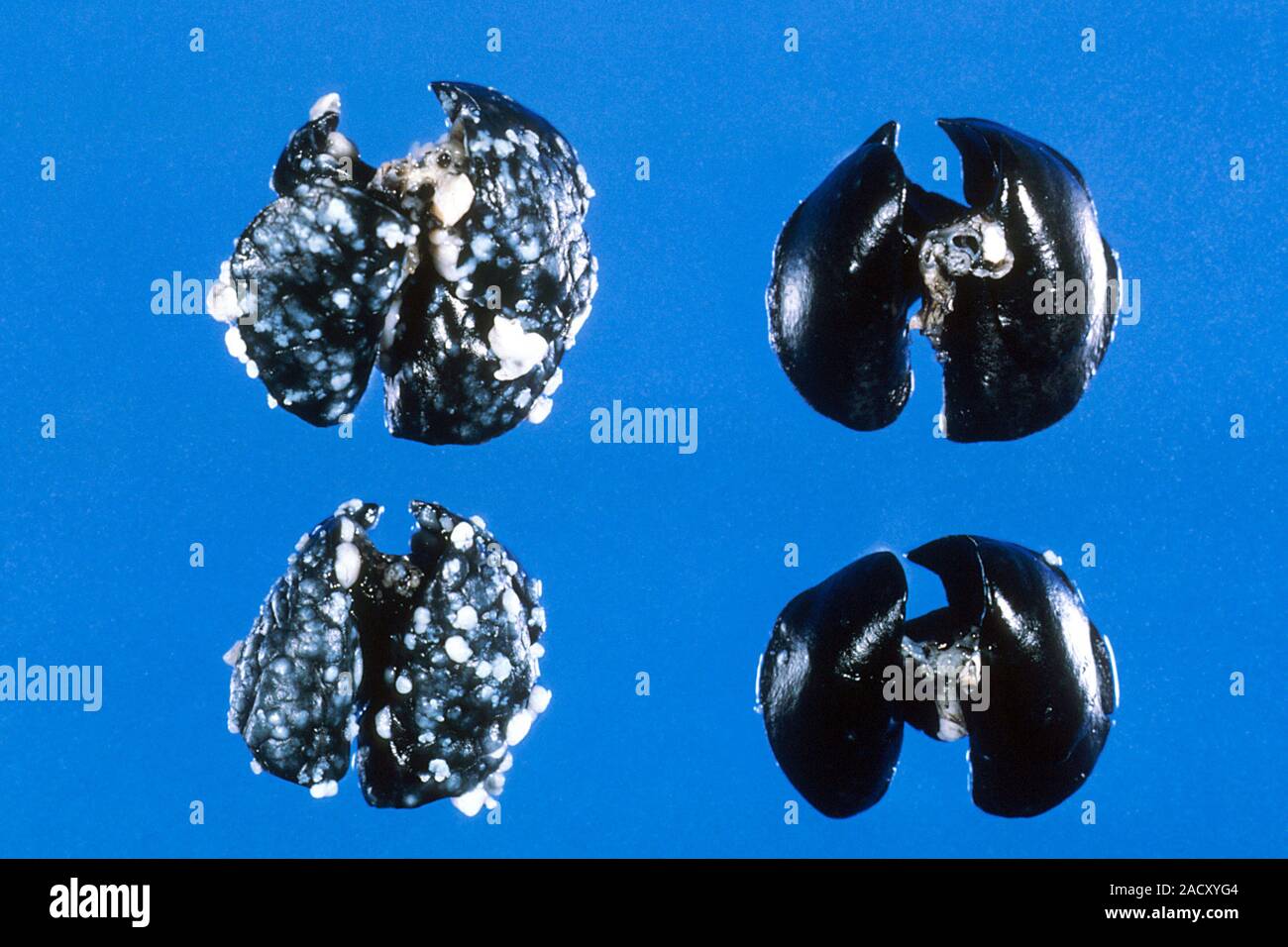 Cancer research on mouse lungs. In this experiment, mice were injected ...