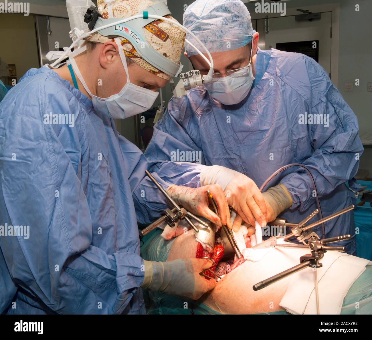 Oesophagogastrectomy surgery. Surgeons performing an ...
